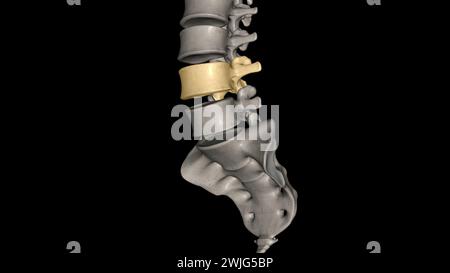 The L4 and L5 are the lowest vertebrae, or spinal bones, in the lumbar ...