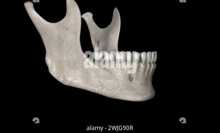 The mandible is the largest and strongest bone of the human skull 3d ...