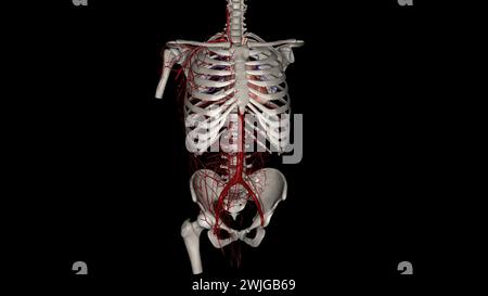 Common arterial trunk is a defect in which a single great artery 3d ...