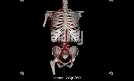 Common arterial trunk is a defect in which a single great artery 3d ...
