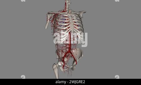 Common arterial trunk is a defect in which a single great artery 3d ...