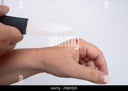 A cut finger from a kitchen accident. Hand injury or wound to the skin ...
