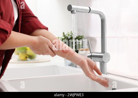 Woman putting hand with burns under cold running water indoors, closeup ...
