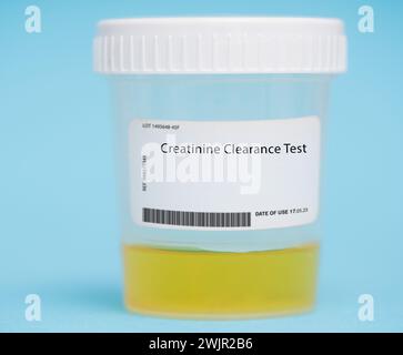 Creatinine clearance test This test measures the rate at which ...