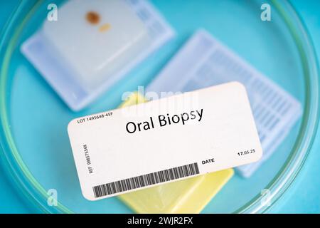 Oral biopsy. A small piece of tissue from the mouth or throat to ...