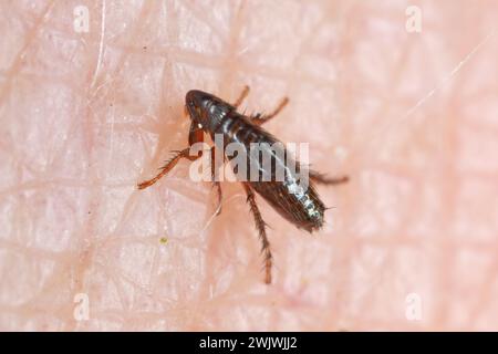 Flea. Insect biting and drinking blood on human skin Stock Photo - Alamy
