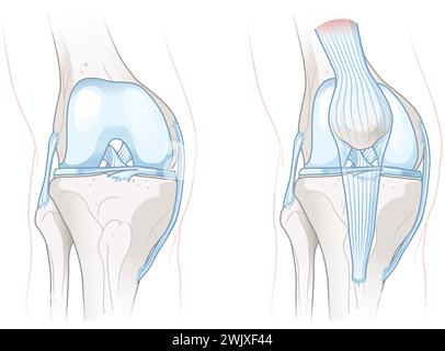 Illustration showing healthy knee joint anatomy Stock Photo - Alamy