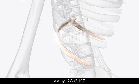 Illustration of a rib fracture Stock Photo - Alamy