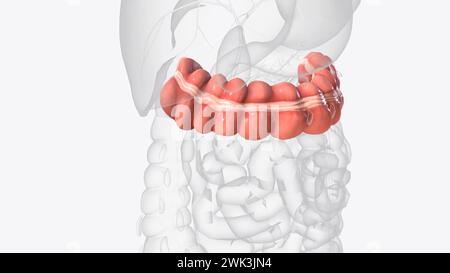 The transverse colon is the lengthy, upper part of the large intestine ...