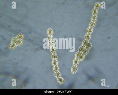 Anamorphs (asexual, reproductive stage) from the basidiomycot fungus ...