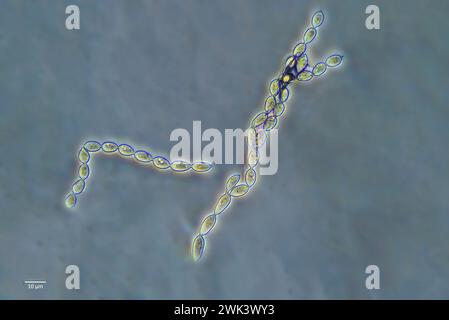 Anamorphs (asexual, reproductive stage) from the basidiomycot fungus ...