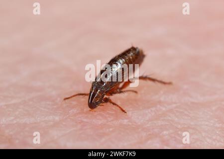 Flea. Insect biting and drinking blood on human skin Stock Photo - Alamy