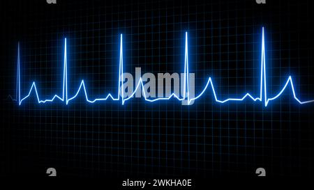 Heart rate electrocardiogram medical screen with grid background Stock ...