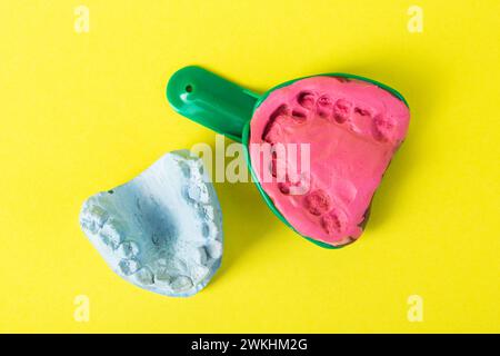 Dental spoon with alginate plastic mass for taking an impression of the ...