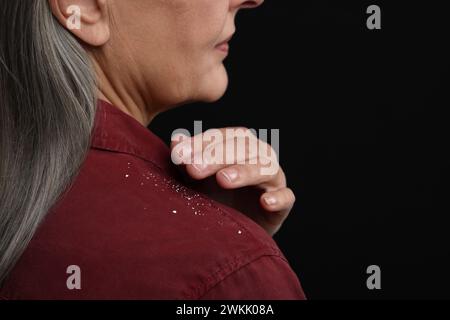 Woman brushing dandruff off her shirt on black background, closeup ...
