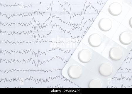 Close up eclectroencephalogram graph on paper, epilepsy diagnosis Stock ...