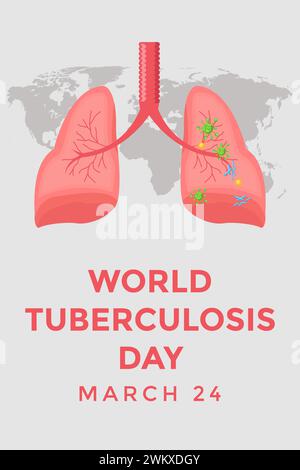 World Tuberculosis Day (TB day) banner backgrounds Stock Vector Image & Art - Alamy