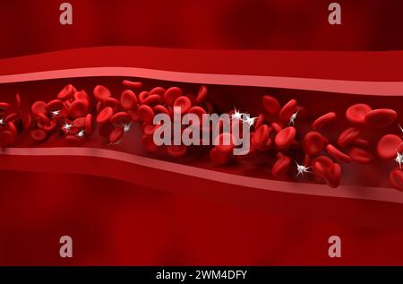 Reduced platelet (thrombocytes) count in Immune thrombocytopenic ...