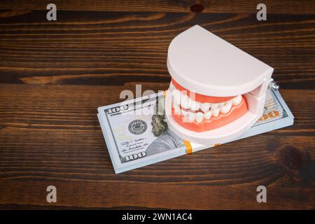 Banknotes in a pile, a model of teeth on top on wooden background ...