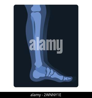 Xray shot of human foot. Medical skeleton test, body radiography ...