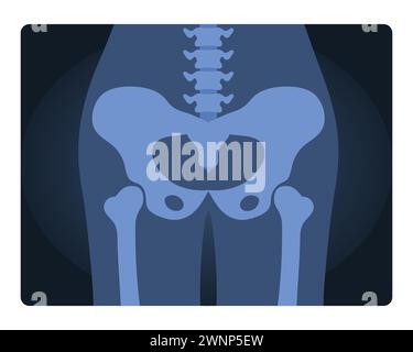 Xray shot of human pelvis. Medical skeleton test, body radiography ...