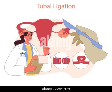 Tubal ligation surgery. Permanent birth control procedure types. Tubes ...