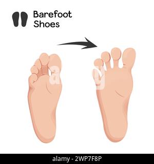 Barefoot shoes care vector illustration infographic. Orthopedic and ...