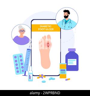 Diabetic foot ulcers, illustration Stock Photo - Alamy