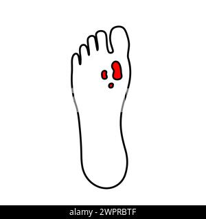 Diabetic foot ulcers, illustration Stock Photo - Alamy