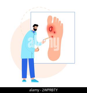 Diabetic foot syndrome treatment, illustration Stock Photo - Alamy