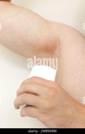 Allergy underarm. Cropped photo of irritation, inflammation on the ...