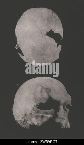 Two views of a human skull, Ville de Paris, c. 1864 - in or before 1869 ...