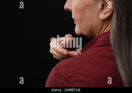 Woman brushing dandruff off her shirt on black background, closeup ...