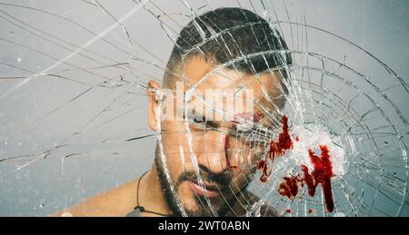 An ill wound is cured. Hispanic man bleeding from bullet wound. Latino ...