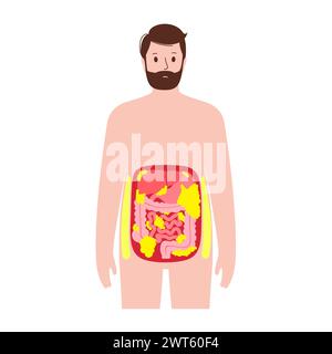 Visceral fat diagram, illustration. Belly fat surrounds internal organs ...