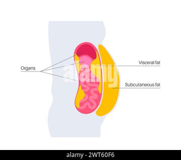 Visceral fat diagram, illustration. Belly fat surrounds internal organs ...
