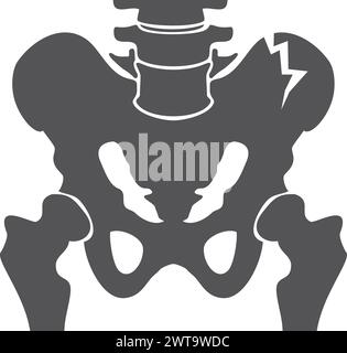 XRay of hip joint pelvis human bones anatomy orthopedic medical ...