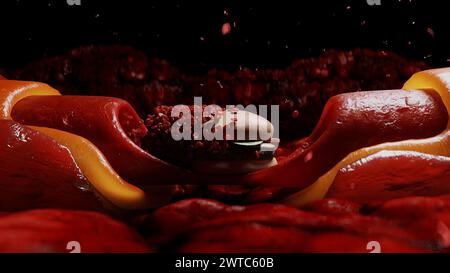 junk food. blood stream and cholesterol plaque, thrombus. health harm ...