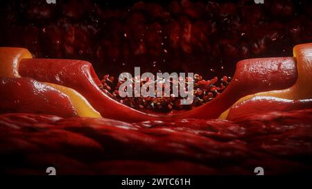 blood stream and cigarette butts. smoking health harm concept. Inside ...