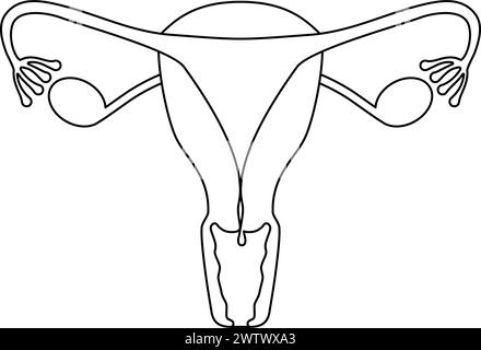 Diagrammatic illustration of cervical polyps, anatomy of the uterus and ...