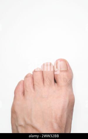 A Close of a person left foot toes with white background and space for ...