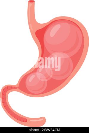 cartoon bloated stomach Stock Vector Image & Art - Alamy