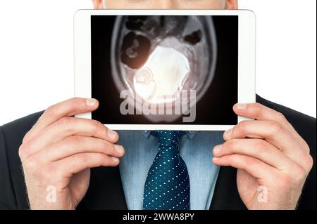 MRI during pregnancy ensures non-invasive evaluation of fetal health ...