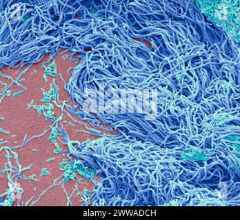 E. coli bacteria. Coloured scanning electron micrograph (SEM) of ...