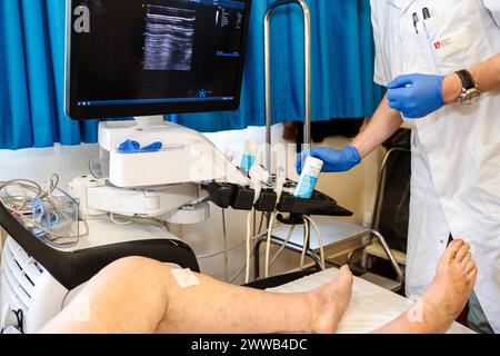 Treatment of varicose veins by foam echosclerotherapy, injection into a ...