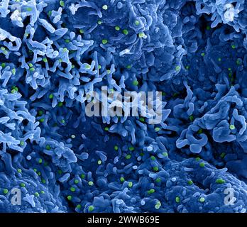 Colorized scanning electron micrograph of monkeypox virus (purple) on ...