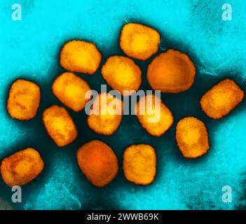 Monkeypox virus particles, TEM Stock Photo - Alamy