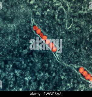 West Nile virus particles, TEM Stock Photo - Alamy