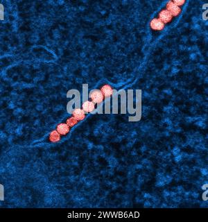 West Nile virus particles, TEM Stock Photo - Alamy