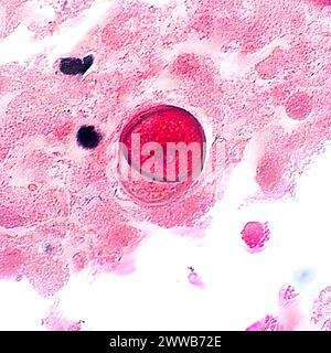 Acanthamoeba is a microscopic, free-living amoeba, or amoeba (single ...